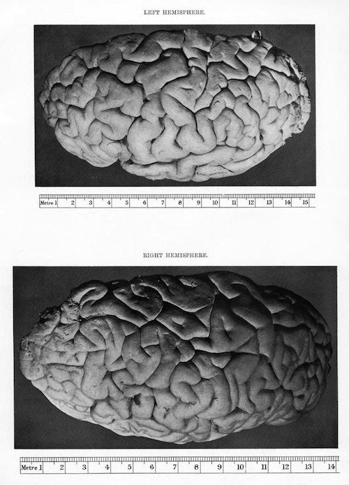 Where do the brains of great thinkers go after they die? | DEATH.io Blog